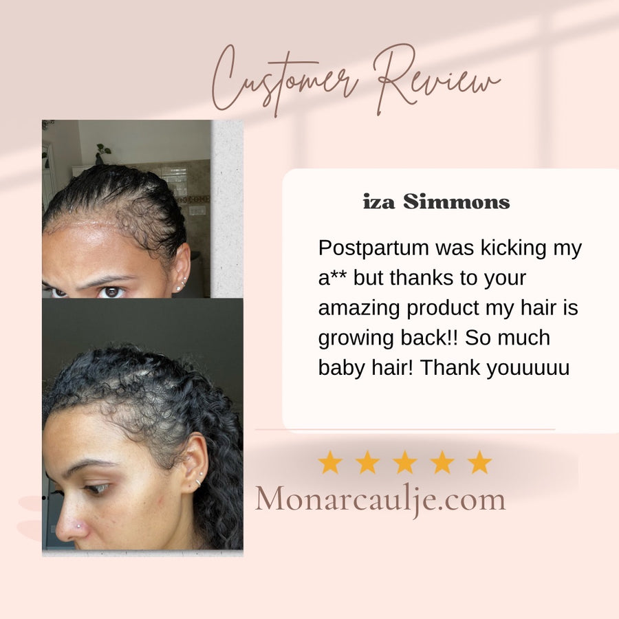 Monarca Ulje Scalp Treatment | Made to order – Monarcaulje