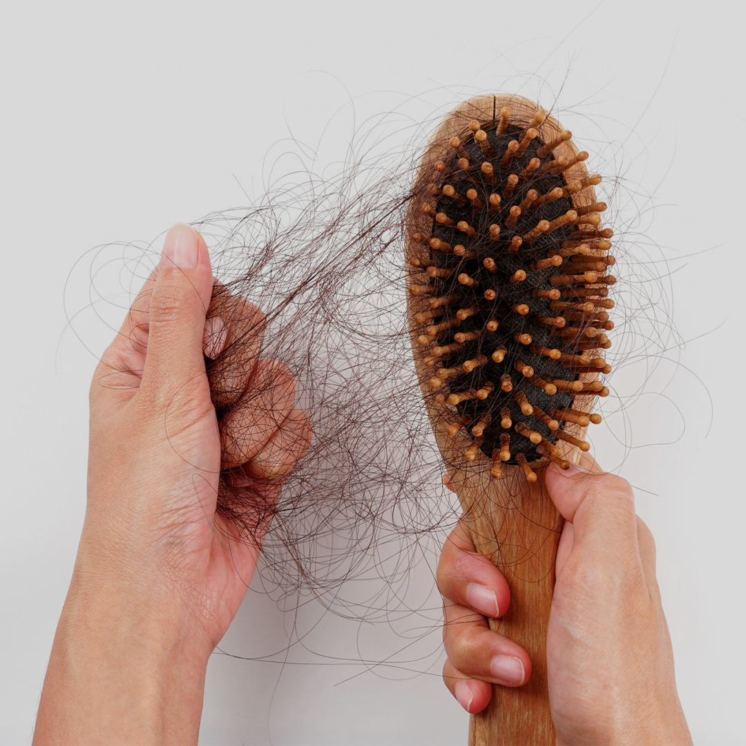 Monarca Ulje | 100% Natural Scalp Treatment & Hair Care Products