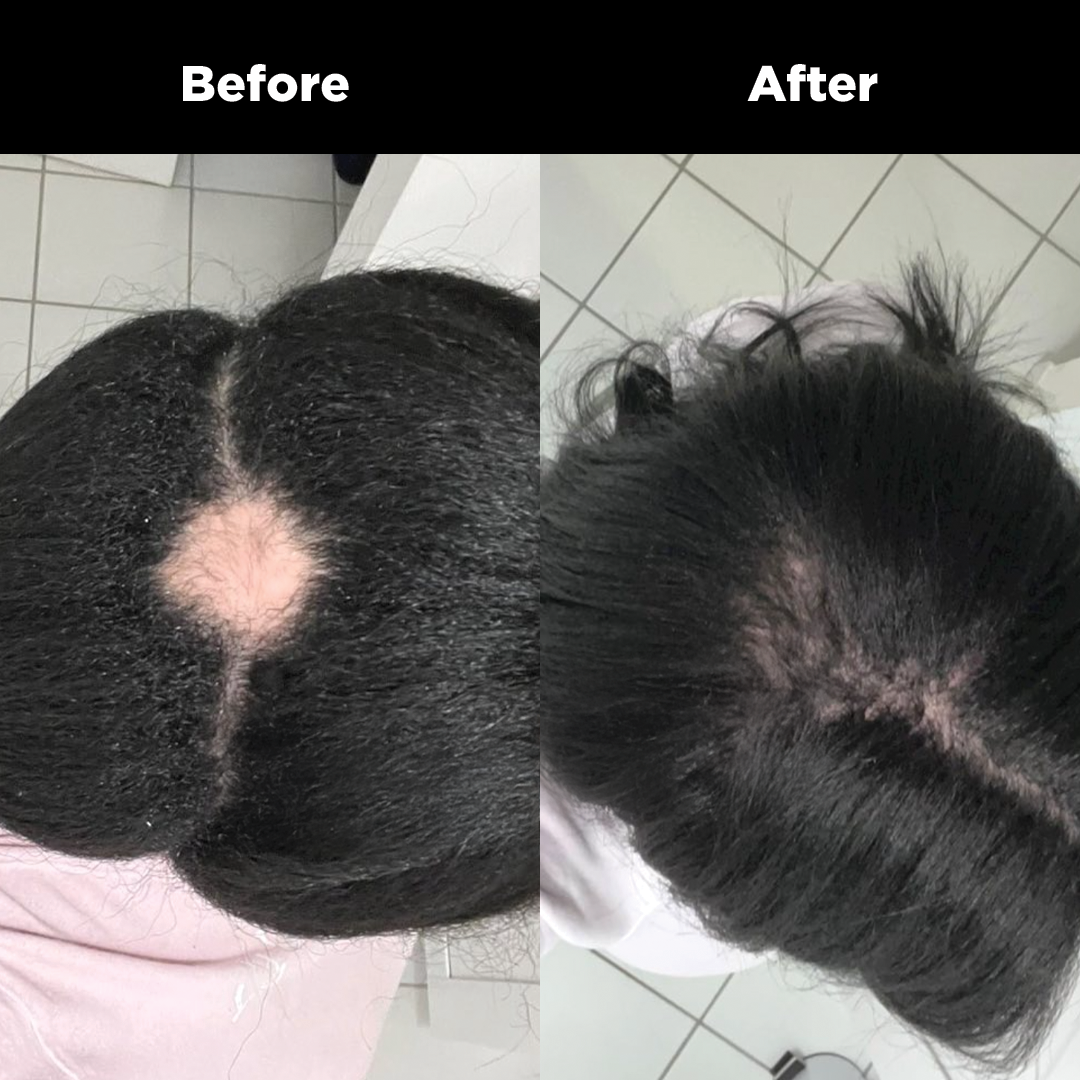 Monarca Ulje | 100% Natural Scalp Treatment & Hair Care Products